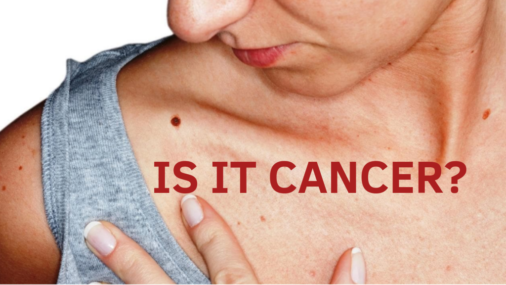 How Is Cancer Diagnosed? - Kymera Independent Physicians